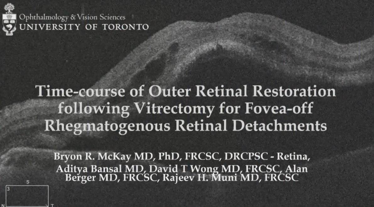 ASRS 2023: Retinal Detachment Symposium – RETINA Roundup
