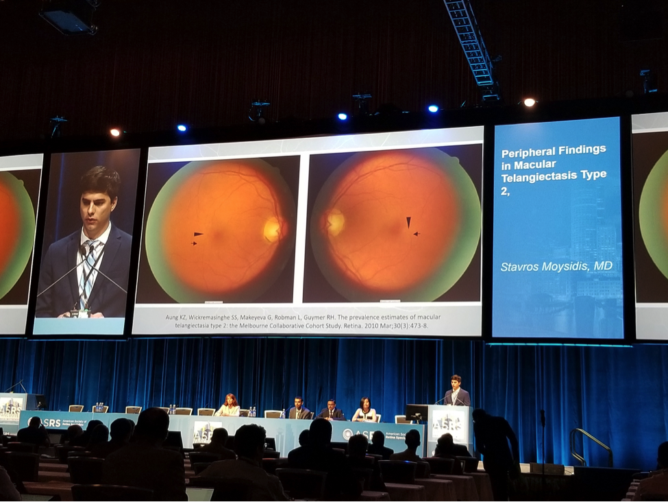 ASRS 2018: Retinal Vascular Session – RETINA Roundup